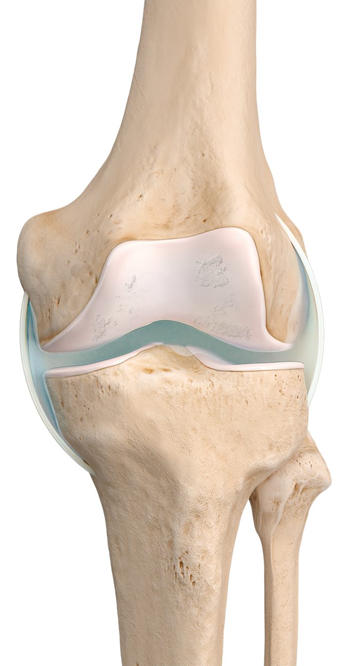 ACP-Therapie - Praxisklinik NeckarAlb
